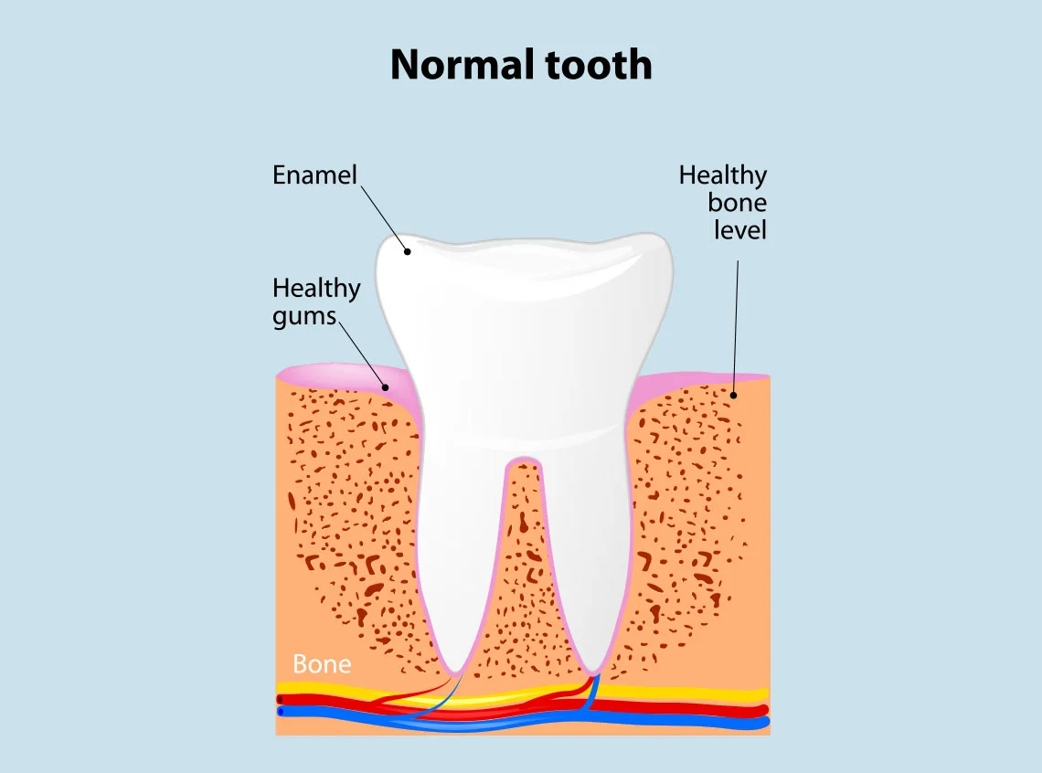 Gum Disease Treatment & Periodontist Balwyn North